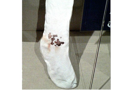 Schilling May Have To Sell Bloody Sock | CSi News Now!